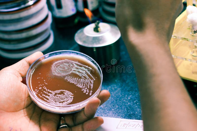 Bacterial Inoculation on a Culture Plate Using Inoculation Loop by ...