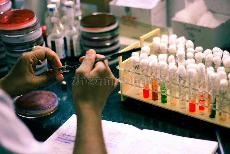 E.coli on EMB Agar stock image. Image of hospital, infection - 56364417