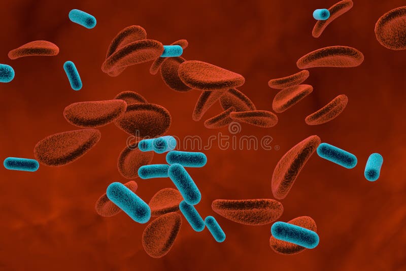 Bacterias En La Sangre, Bacteriemia Stock de ilustración - Ilustración ...