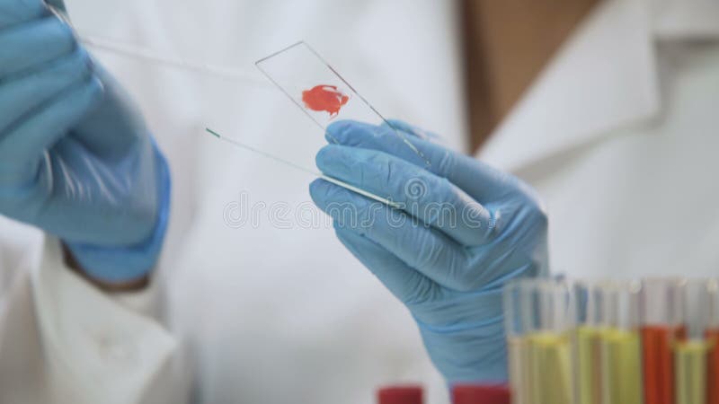 Bacteriologist Analyzing Microbiological Specimens, Blood Sample, HIV ...