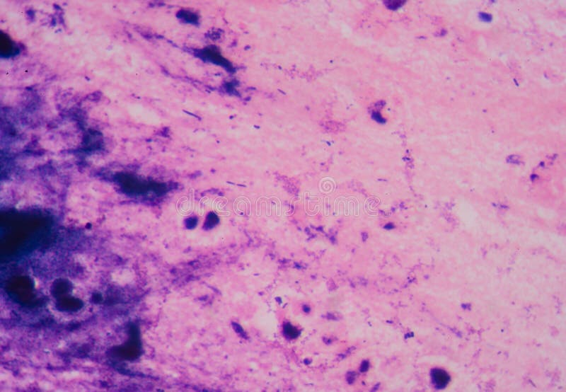 Bacterium stock photo. Image of laboratory, biotechnology - 83576734