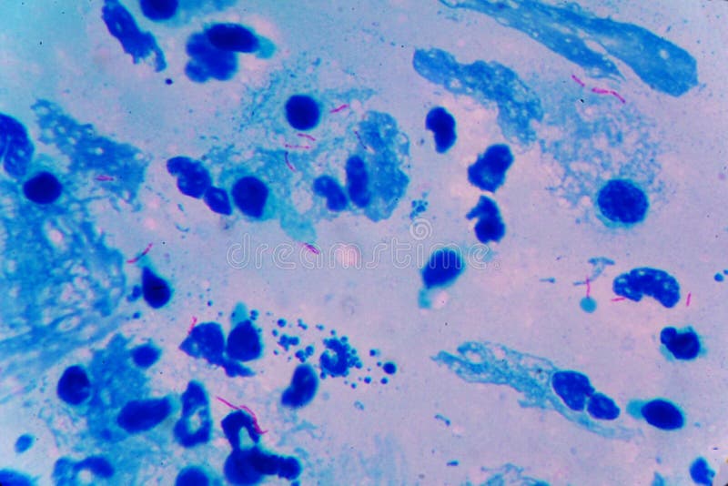 Images of AFB - JapaneseClass.jp