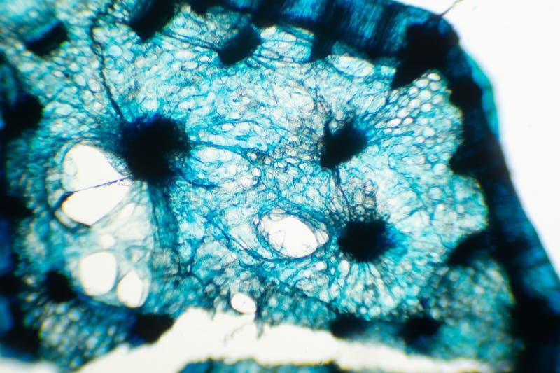 The Picture Shows a Blue Bacterium Under a Microscope Stock Image ...