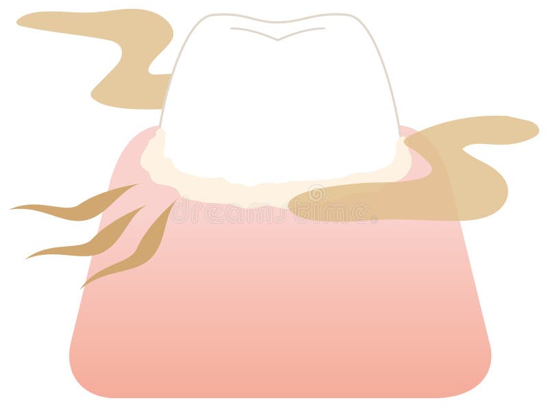 Bad Breath Teeth Illustration Vector Stock Vector - Illustration of ...