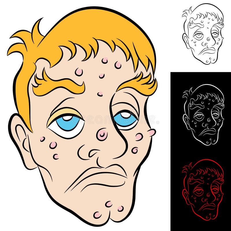 Bad Face Man stock vector. Illustration of pimple, breaking - 19824311
