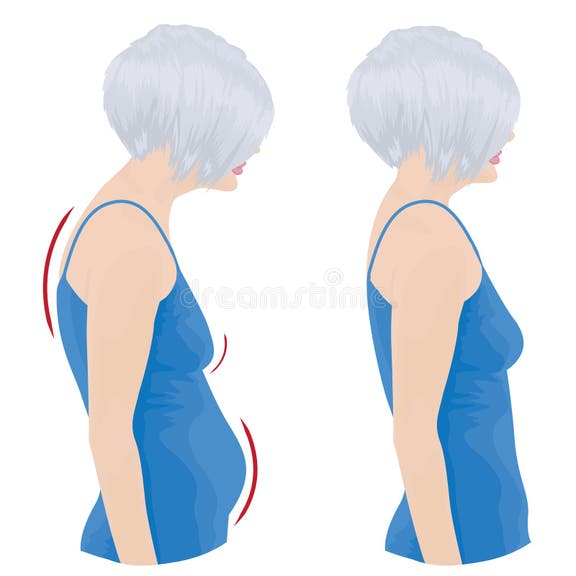 Poor Posture Stock Illustrations – 497 Poor Posture Stock Illustrations ...