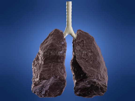 Bad Lungs Stock Illustrations – 535 Bad Lungs Stock Illustrations ...