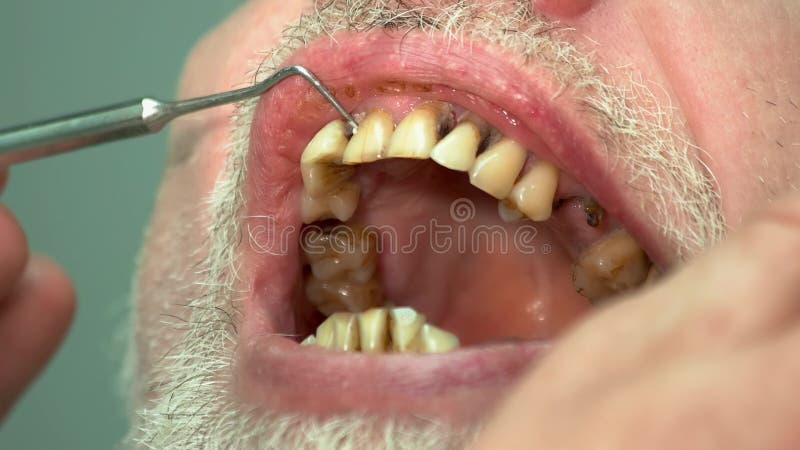 Dental with bad teeth stock illustration. Illustration of dentist ...