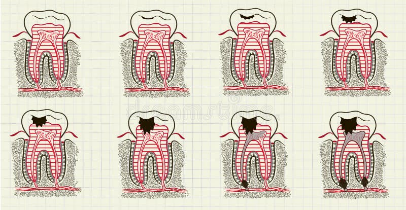 Bad tooth stock vector. Illustration of explanations - 55017549
