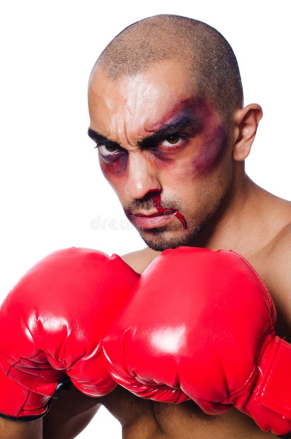 230 Fighter Man Bruise Stock Photos - Free & Royalty-Free Stock Photos ...