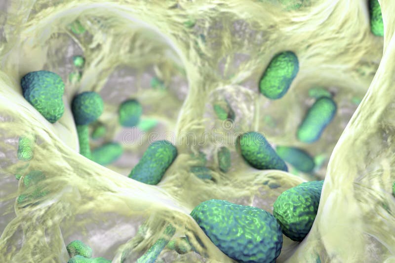 Bakterien-Acinetobacter Baumannii Innerhalb Des Biofilm Stock Abbildung ... Bakterien-Acinetobacter Baumannii Innerhalb Des Biofilm Stock Abbildung ...
