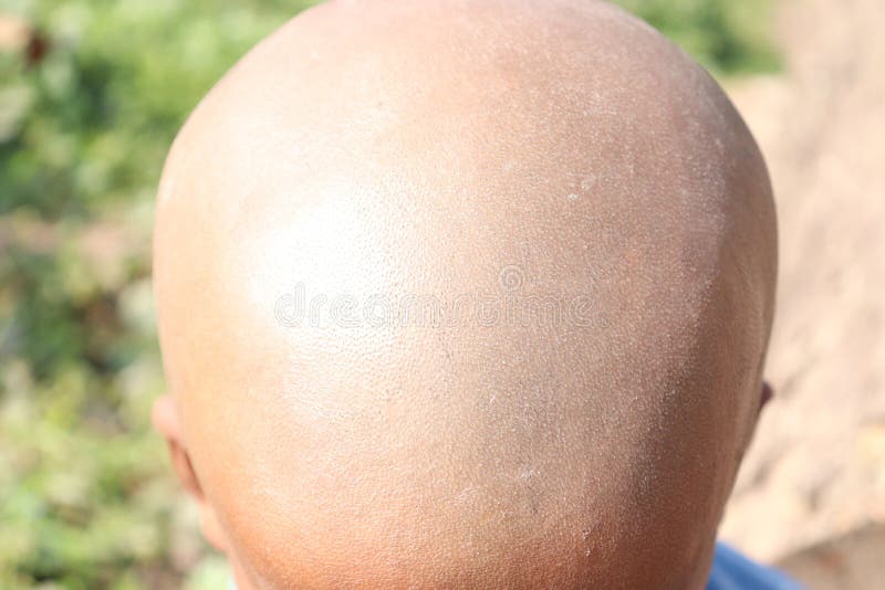 A bald closeup of child stock image. Image of hair, children - 236126389