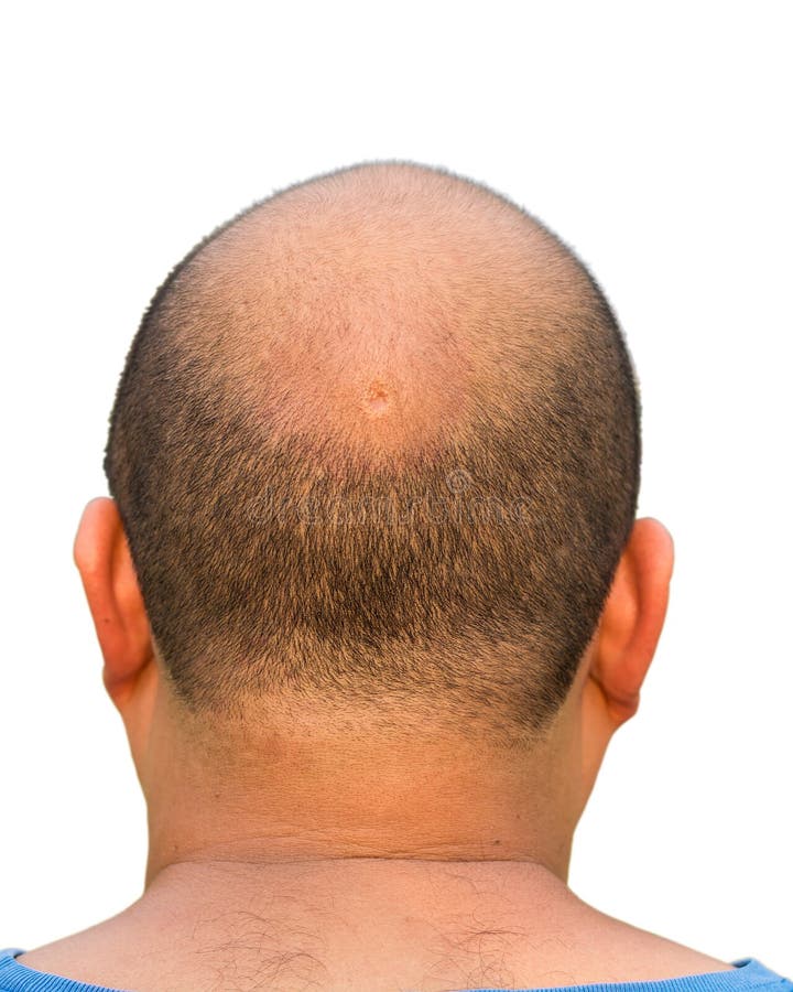 Bald head isolation stock photo. Image of head, crater - 29411152