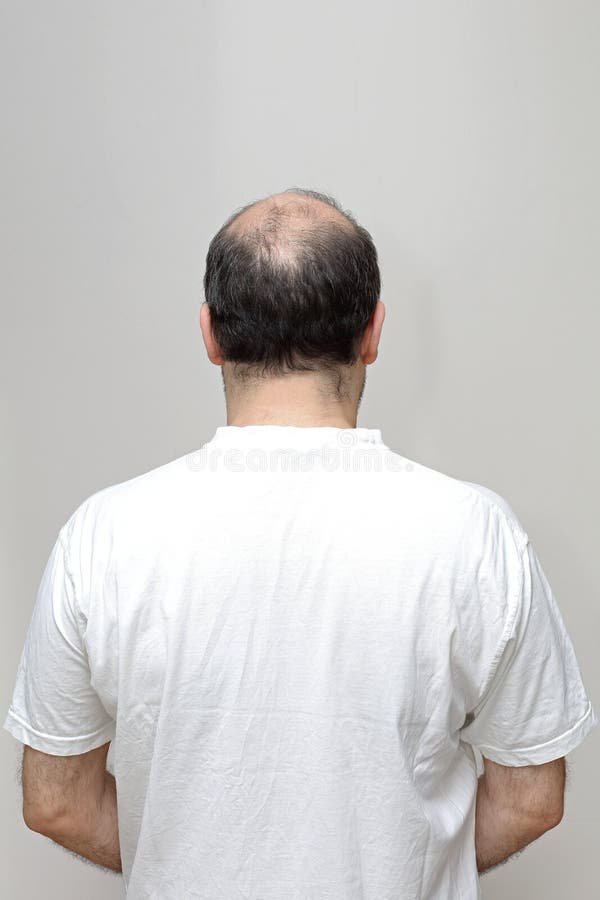 Back Bald Head Man Stock Photos - Download 504 Royalty Free Photos