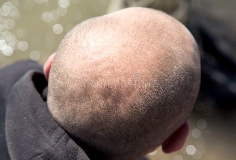 Bald head of a man stock photo. Image of white, people - 98198230