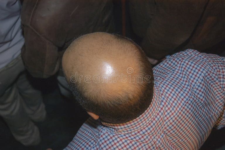 430 Top View Bald Head Stock Photos - Free & Royalty-Free Stock Photos ...