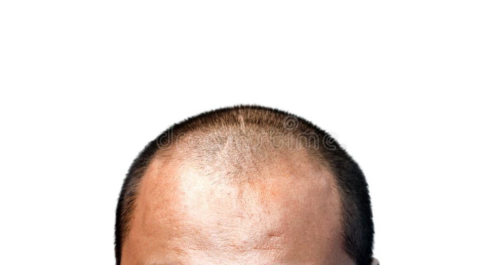 433 Top View Bald Head Stock Photos - Free & Royalty-Free Stock Photos ...