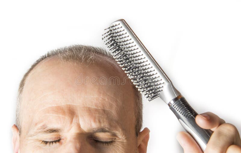 Bald Man with Comb. Hair Loss Concept Stock Photo - Image of concern ...