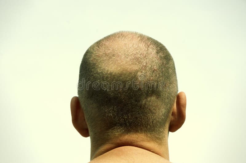 Baldness stock image. Image of shaved, skin, adult, style - 1781029