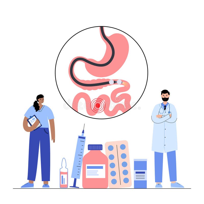 Balloon Assisted Enteroscopy Stock Vector - Illustration of anatomical ...