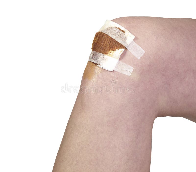 Band-aid on knee. stock photo. Image of wound, adhesive - 27951090