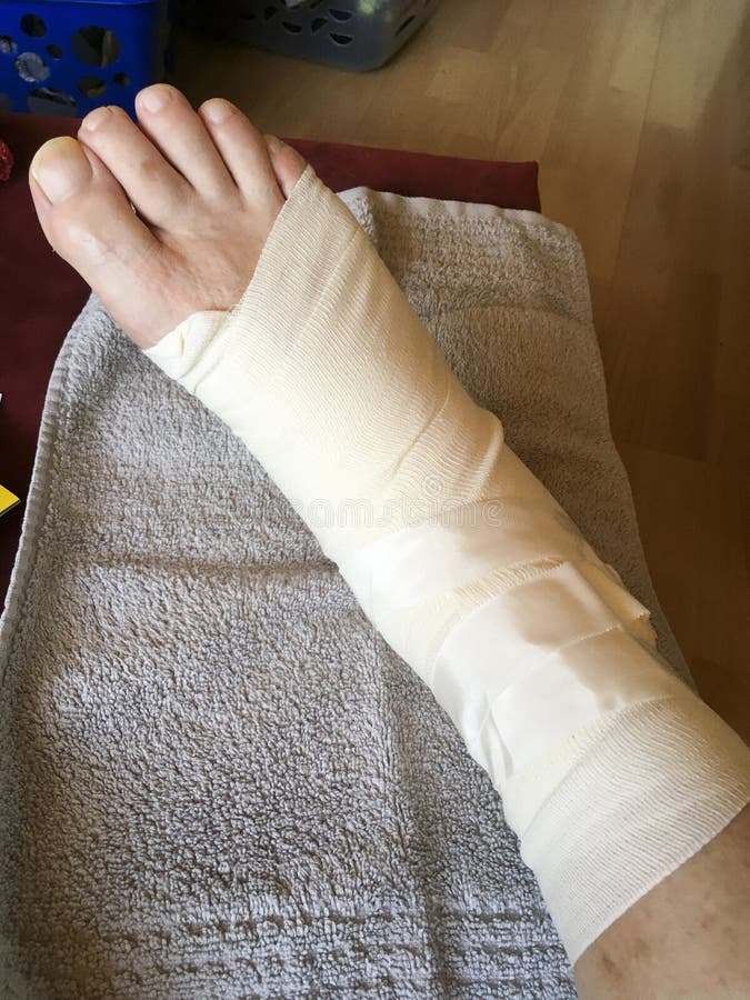 Bandage Around the Foot at the Heel Stock Image - Image of joint ...
