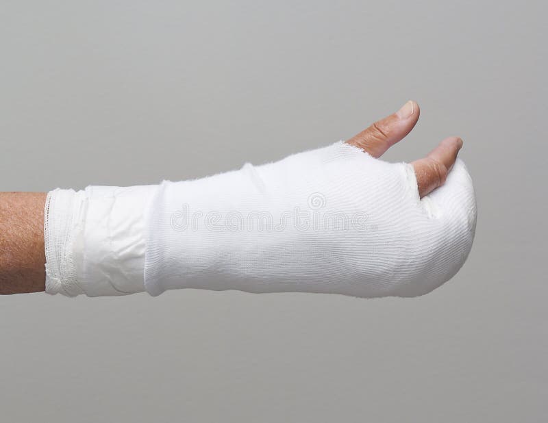 Bandaged arm and fingers stock image. Image of support - 15947415