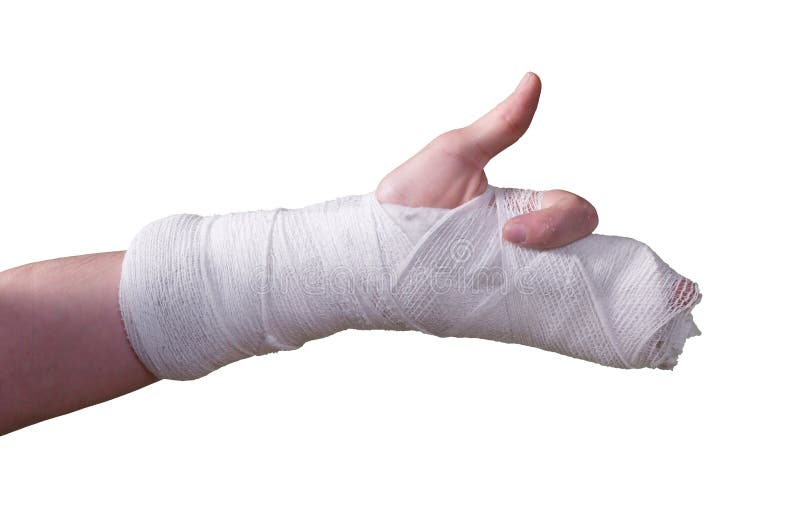 Bandaged Hand Showing Thumb Up. Hand Injury Stock Photo - Image of ...