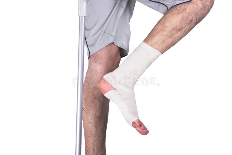 Bandaged leg damaged stock photo. Image of foot, crutch - 53664120