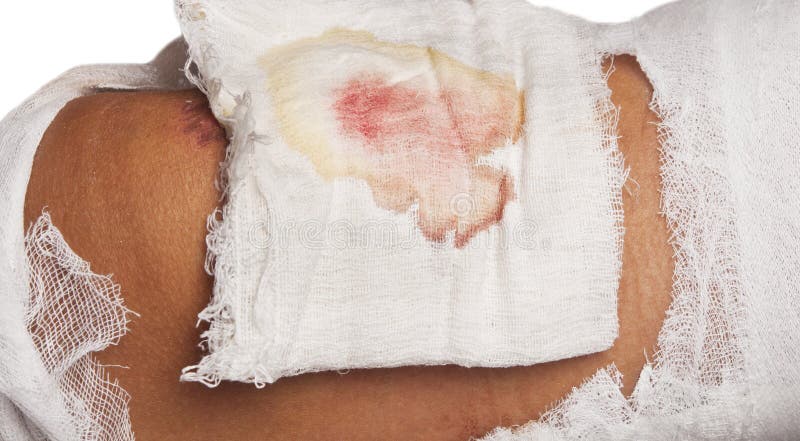 Bandaged Wound Royalty Free Stock Photography - Image: 28308027