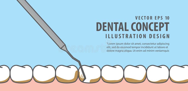 Banner Scaling Teeth Illustration Vector on Blue Background. Den Stock ...