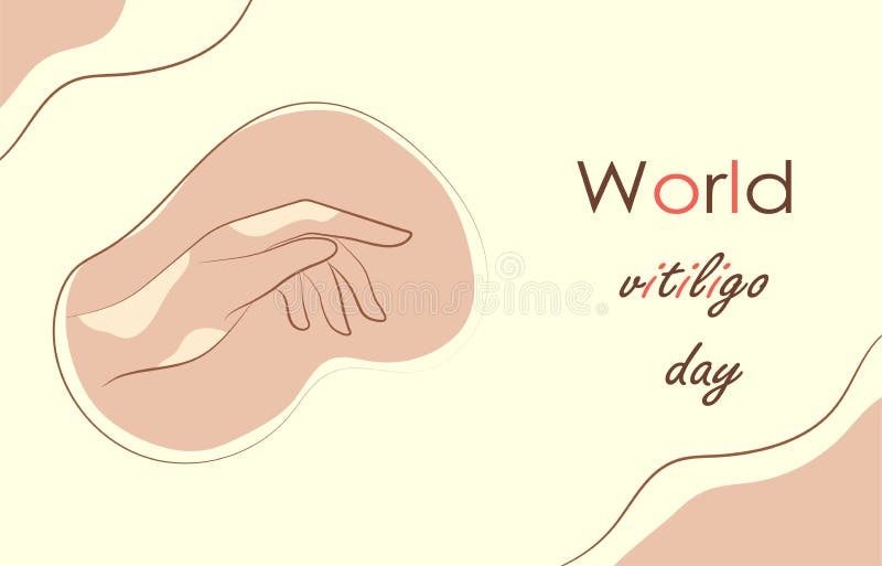 Banner World Vitiligo Day With Hand Vector Illustration With White