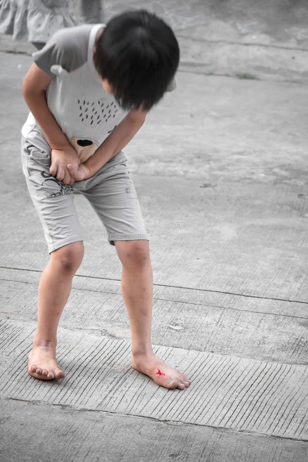 Bare Foot Bleeding after Injury on a Boy Stock Image - Image of agony ...