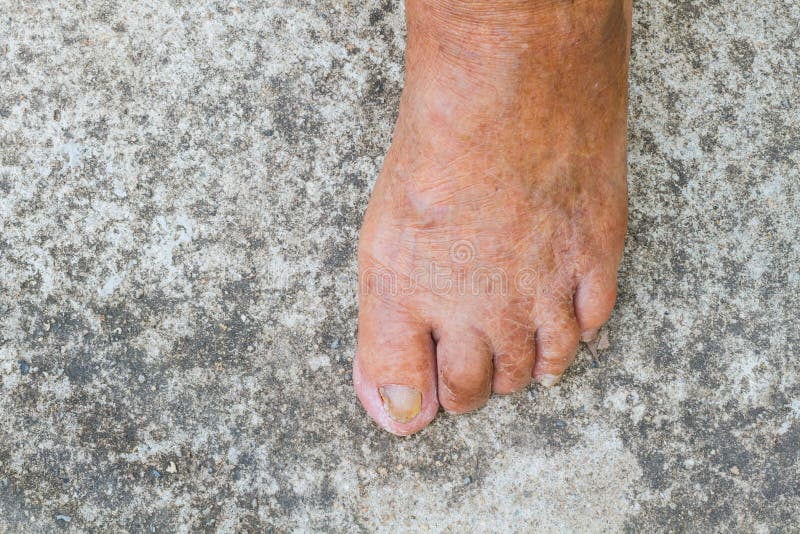 Bare Foot of old man stock photo. Image of adult, healthy - 53657586