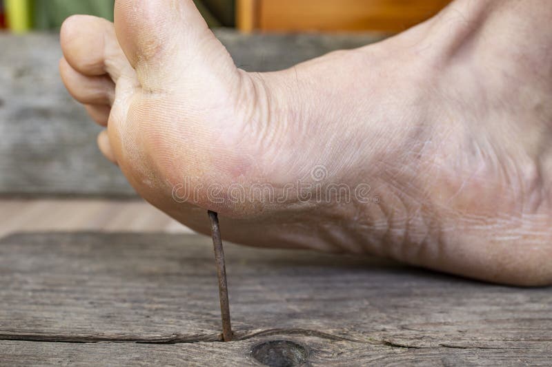 Bare Foot Stepping on a Sharp Rusty Nail from a Weathered Wooden Board ...