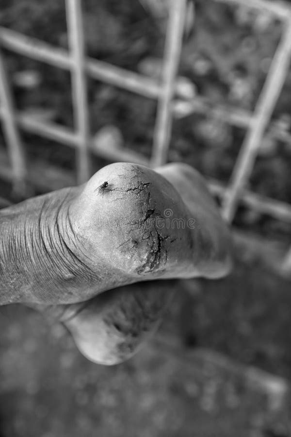 Barefoot of a Poor Old Man , India Stock Photo - Image of poor, india ...