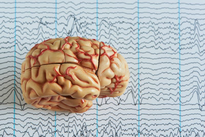 Background of Brain Waves on the Paper Stock Image - Image of ...