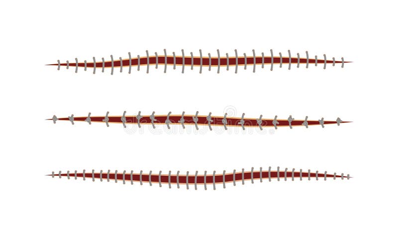 Baseball Stitches and Red Lace with Loop of Thread Isolated on White ...