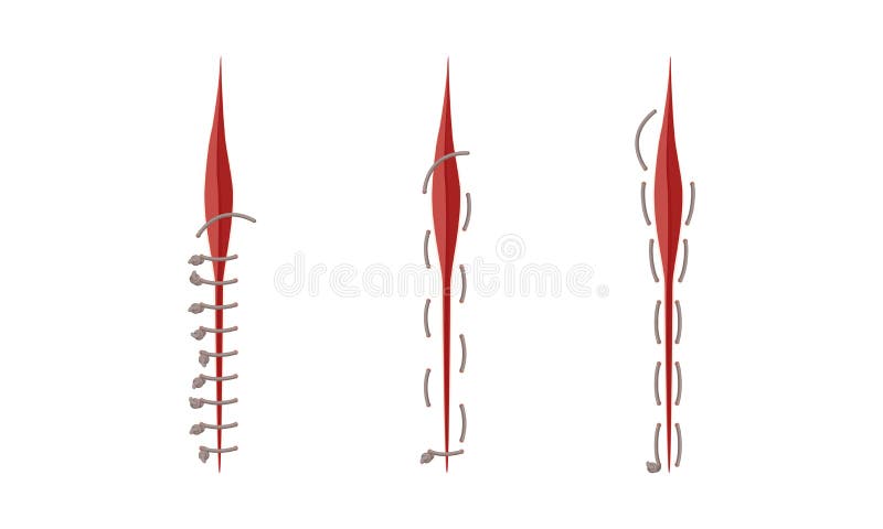 Baseball Stitches and Red Lace with Loop of Thread Isolated on White ...