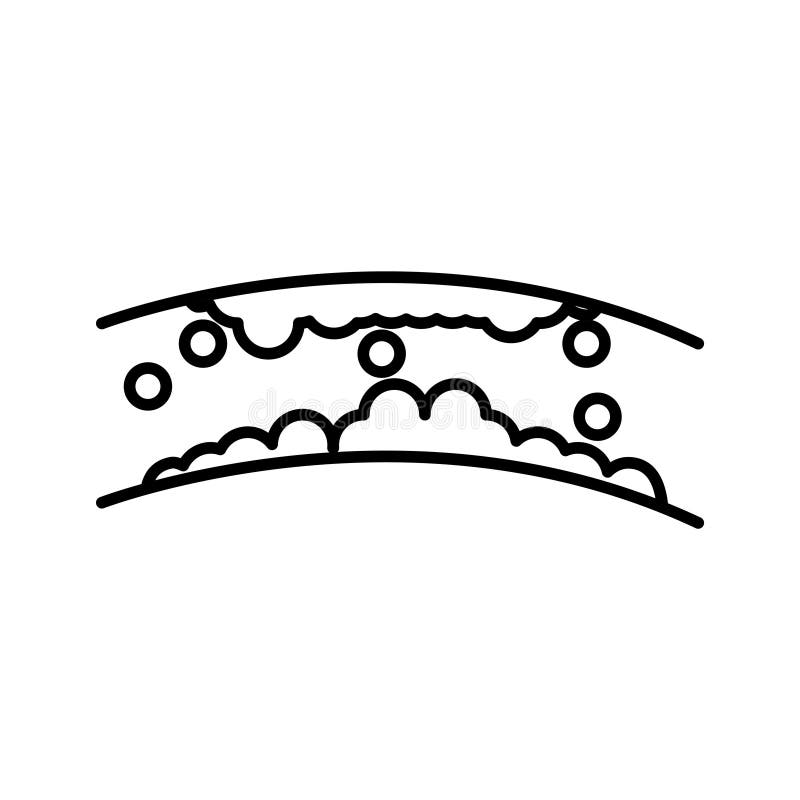 Cholesterol Icon, Artery Blocked with Cholesterol, Line Illustration ...