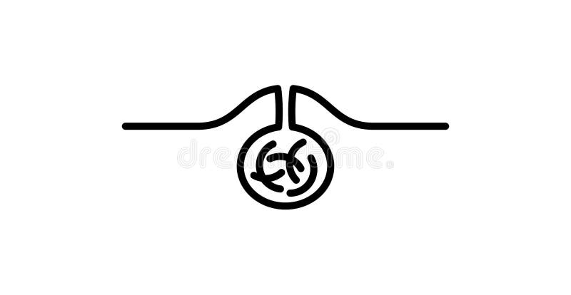 Pilonidal Cyst Stock Illustrations – 11 Pilonidal Cyst Stock ...