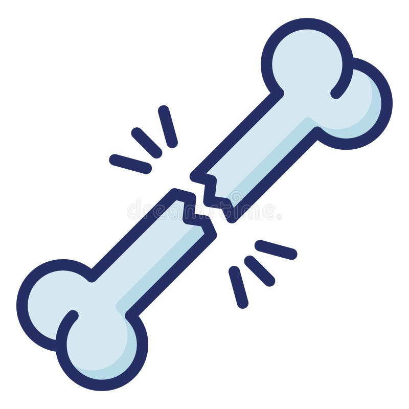 Bone Fracture Isolated Vector Icon that Can Be Easily Modified or Edit ...