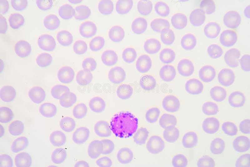 Basophil granulocyte stock photo. Image of bone, infection - 49362754