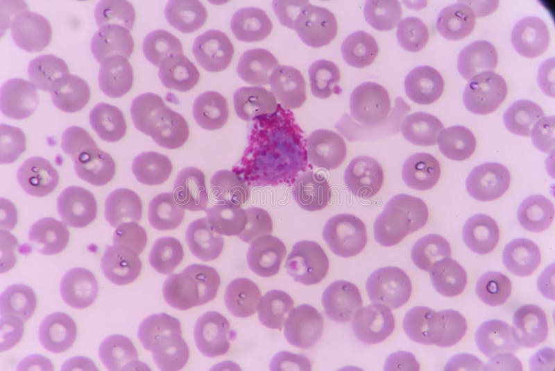 Basophil stock photo. Image of basophil, smear, blood - 58882264