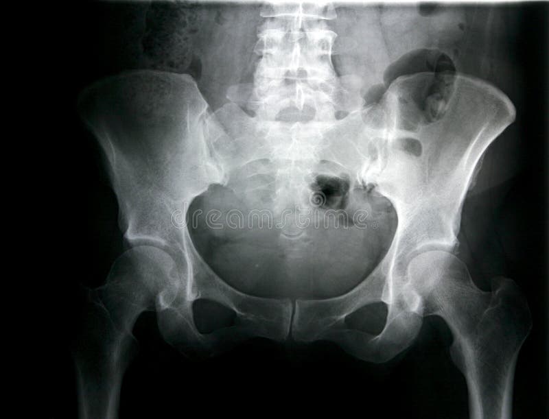 Bassin femelle photo stock. Image du anatomie, film, pièces - 198778