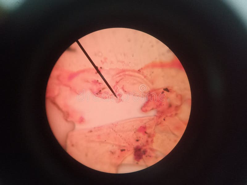 Mikroorganisme Stock Photos - Free & Royalty-Free Stock Photos from ...