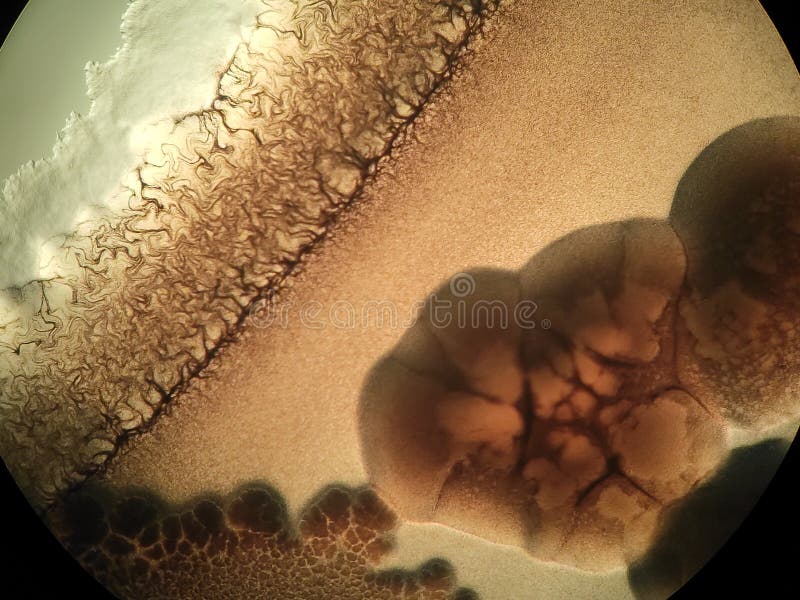 The Beautiful Art of Bacteria - Microscope View of Bacillus and Other ...