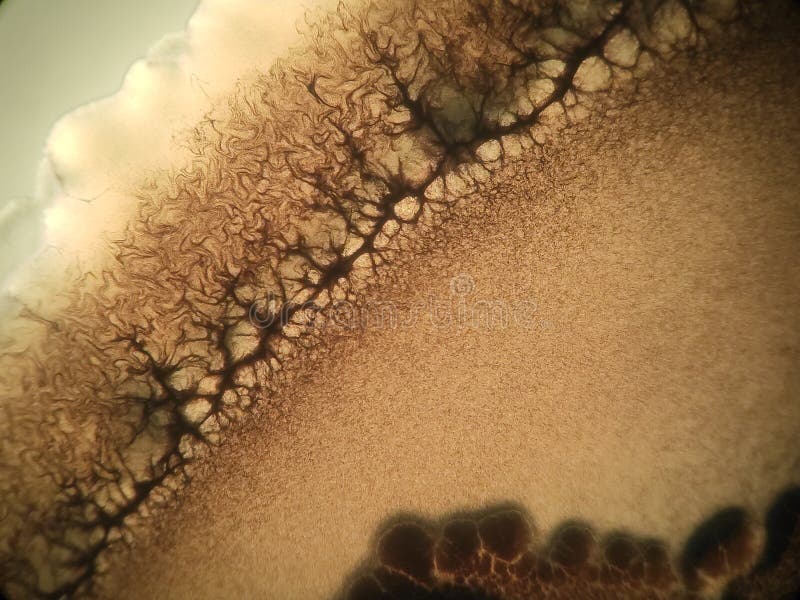 The Beautiful Art of Bacteria - Microscope View of Bacillus and Other ...