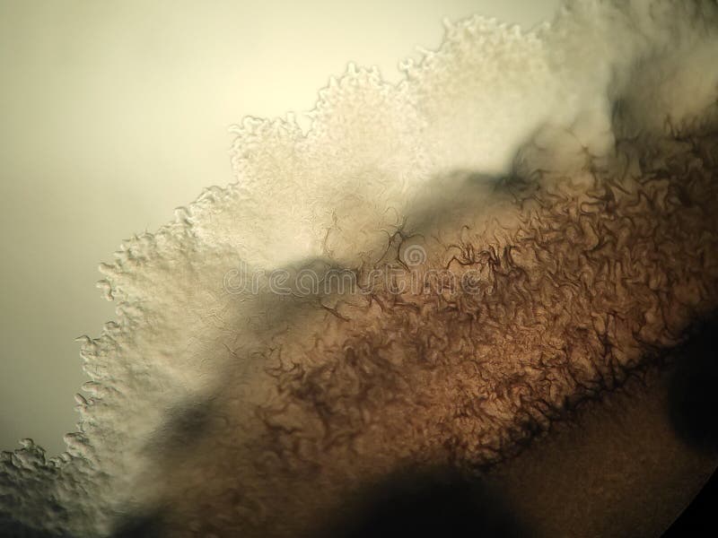 The Beautiful Art of Bacteria - Microscope View of Bacillus and Other ...