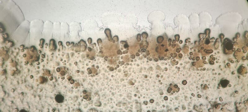 Beautiful Bacterial Colony Under the Microscope Stock Photo - Image of ...